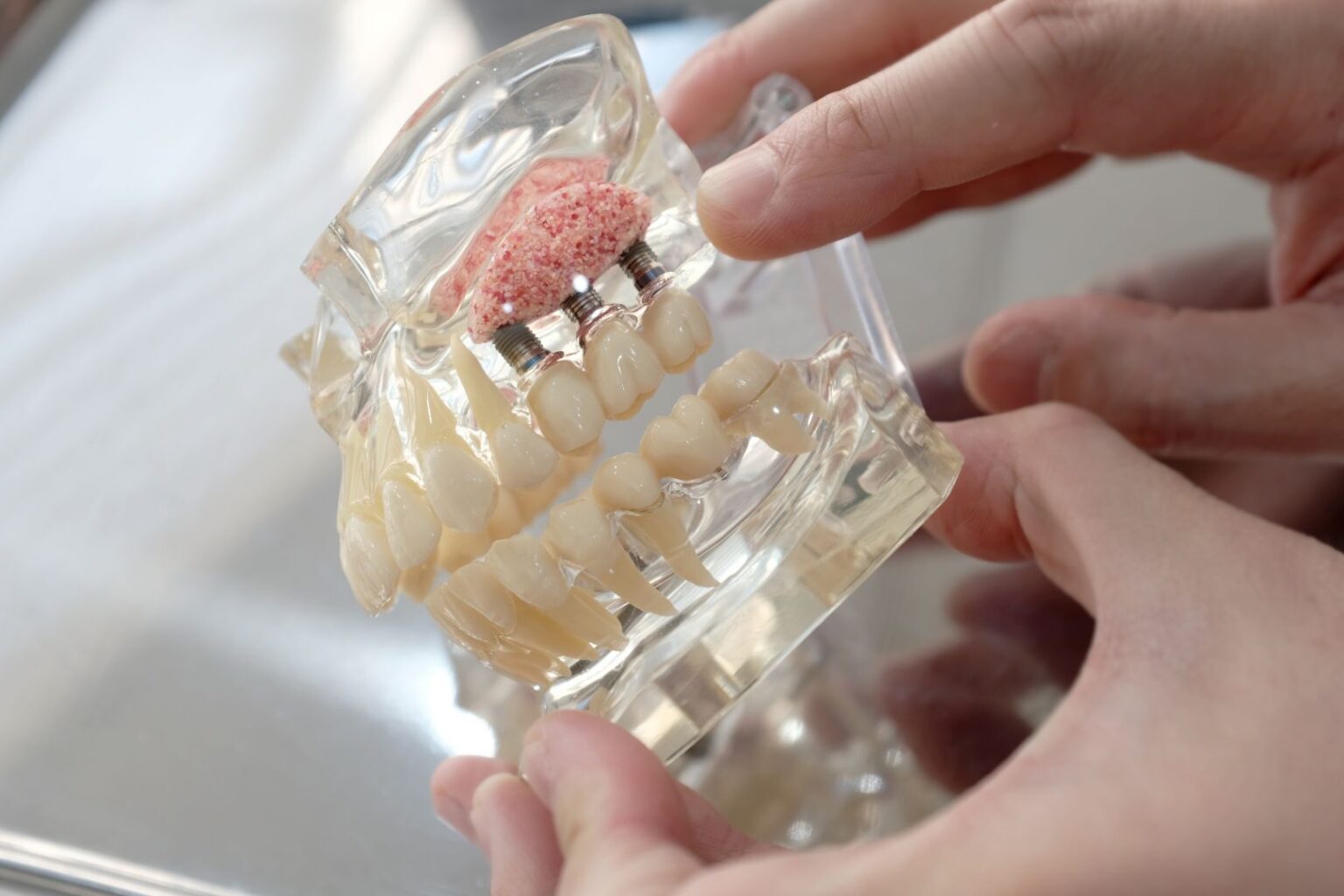 Bone Grafting Explained: Different Types and What to Expect - Babston ...